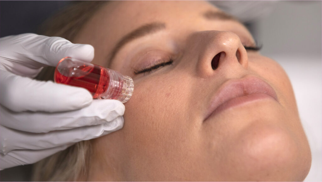 What is Skin Fusion Therapy? | WY Skin Clinic