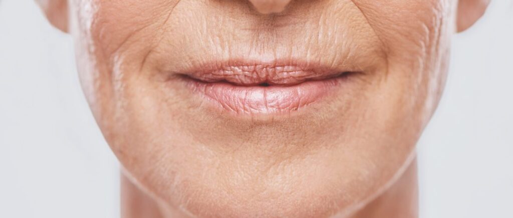 Treatments to Improve Skin Elasticity | WY Skin Clinic